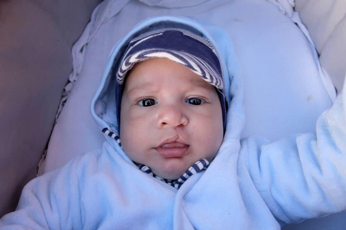 Wat is een open gehemelte bij je baby? - Meer Voor Mama’s - Baby